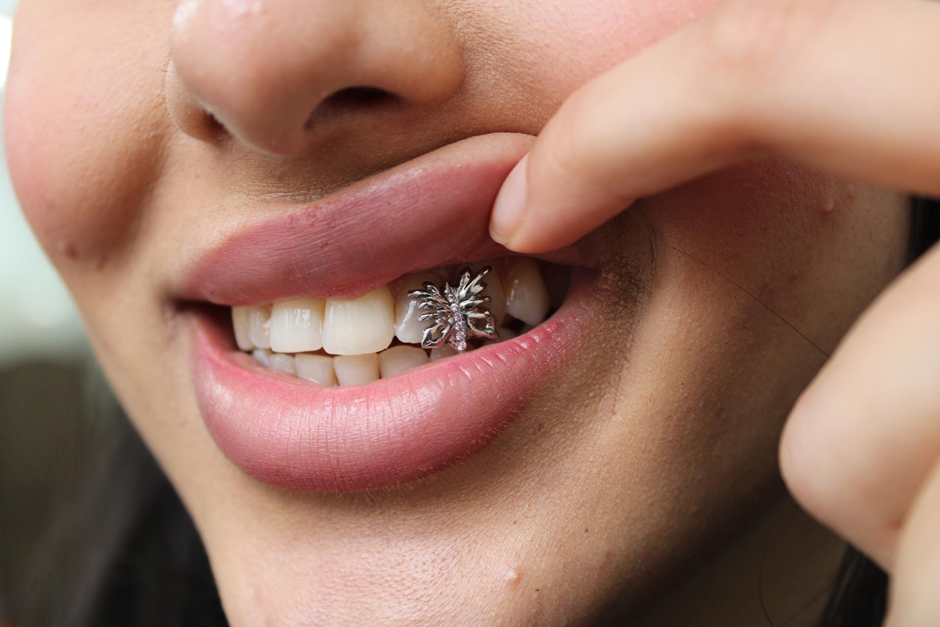 History of mouth grillz | FLANNELS